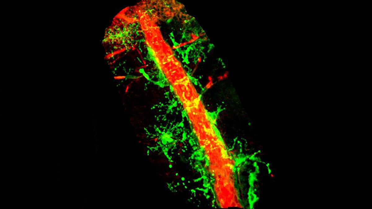 A Negative Immune Regulator Controls Wet AMD