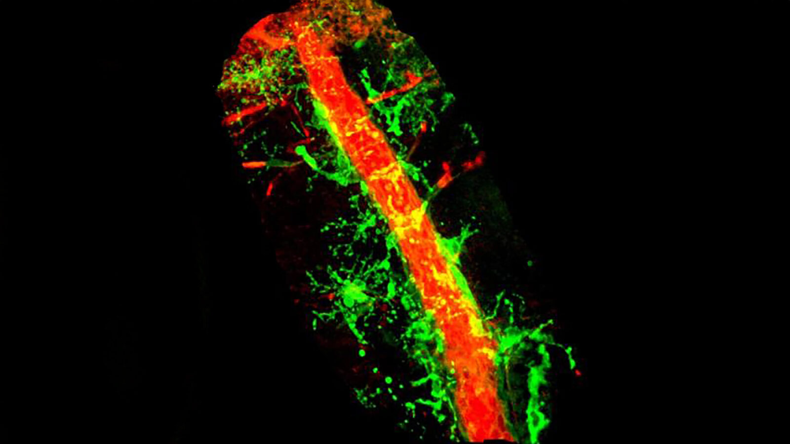 A Negative Immune Regulator Controls Wet AMD