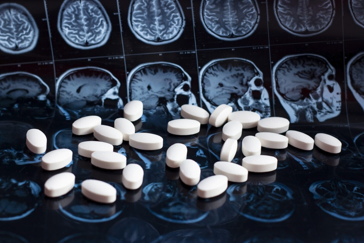How GLP-1s Could Transform Alzheimer's Treatment