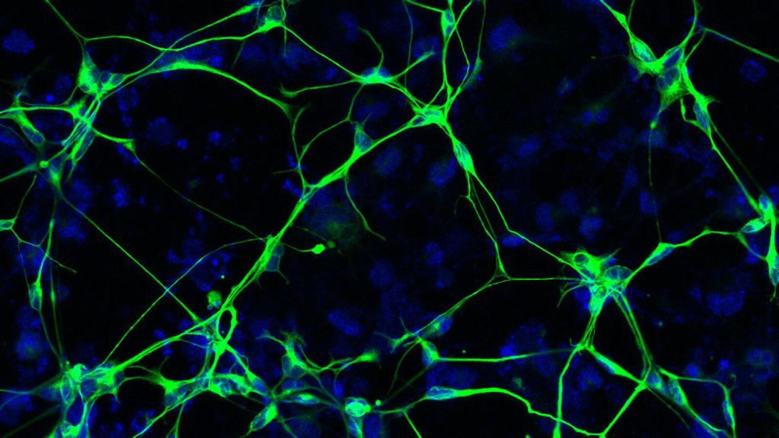 Deteriorating Neurons Are Source of Human Brain Inflammation in ...