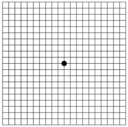 Amsler Grid Eye Test