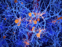 What are Alzheimer’s Plaques and Tangles?