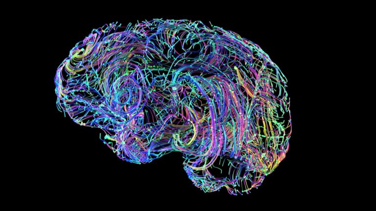 How Does Alzheimer’s Disease Affect the Brain?