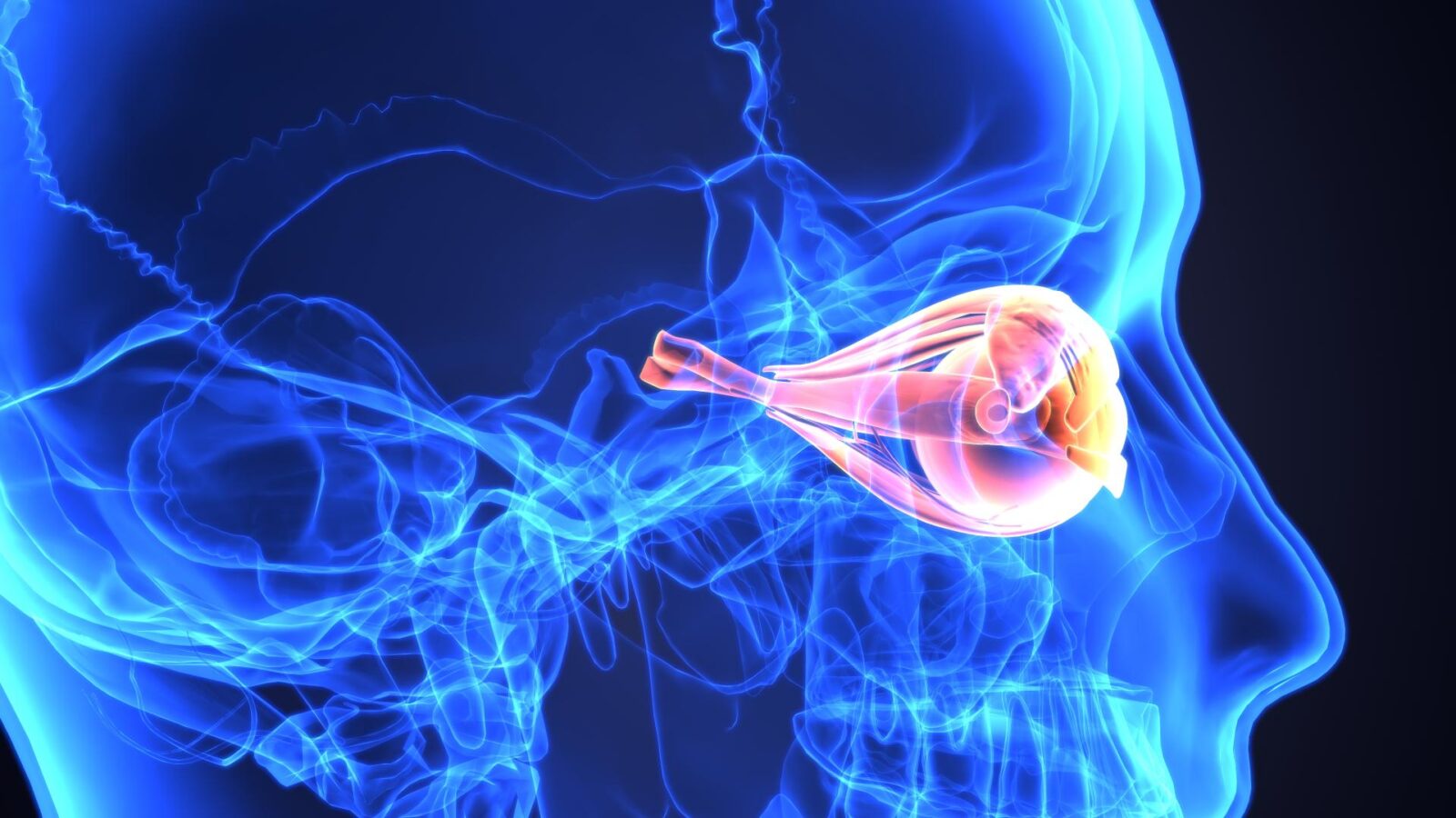 Glaucoma: Understanding Optic Nerve Imaging