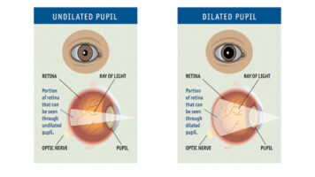 The Dilated Eye Exam: Why It's So Important