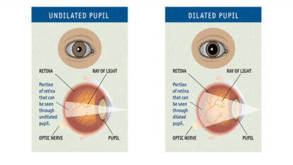 The Dilated Eye Exam: Why It's So Important