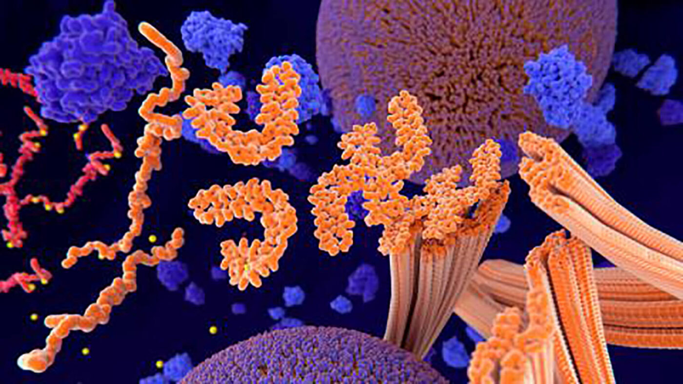 Tau Master Sites: Drivers of Causative Processes in Alzheimer's Disease