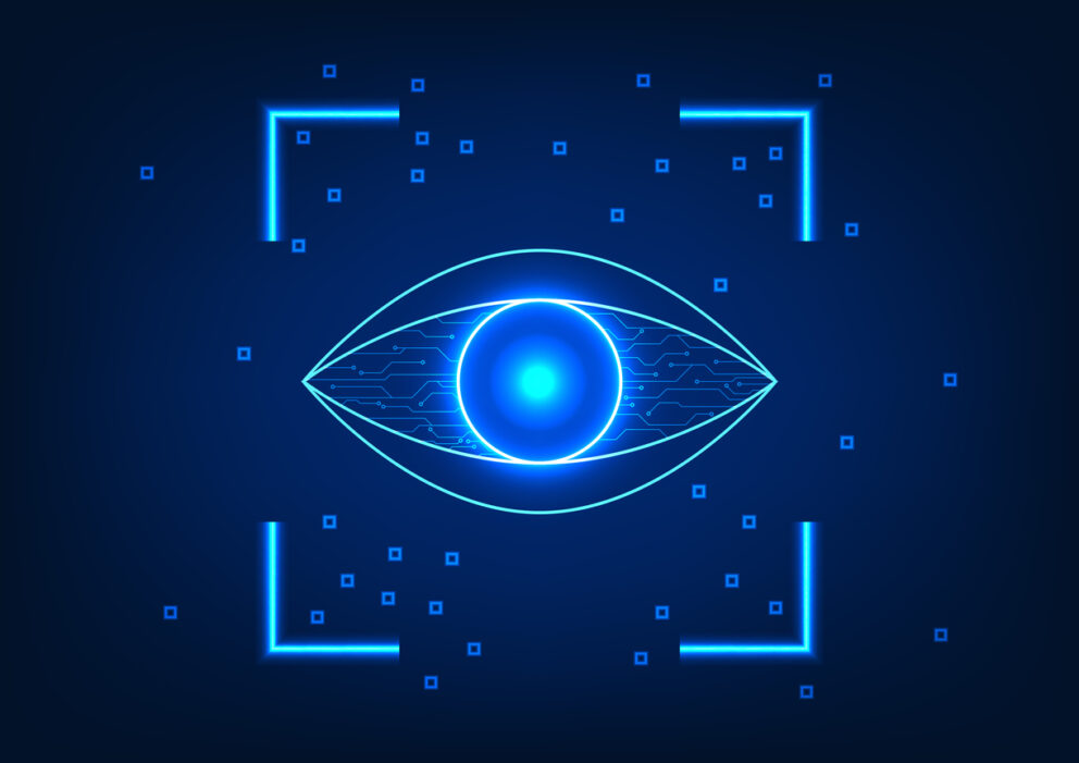 Laser Peripheral Iridotomy: Surgery for Narrow-Angle Glaucoma