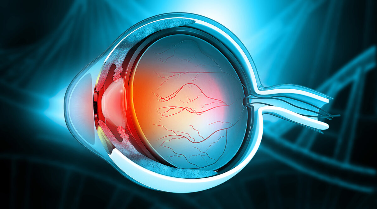 Macular Degeneration Research Program Overview | BrightFocus Foundation